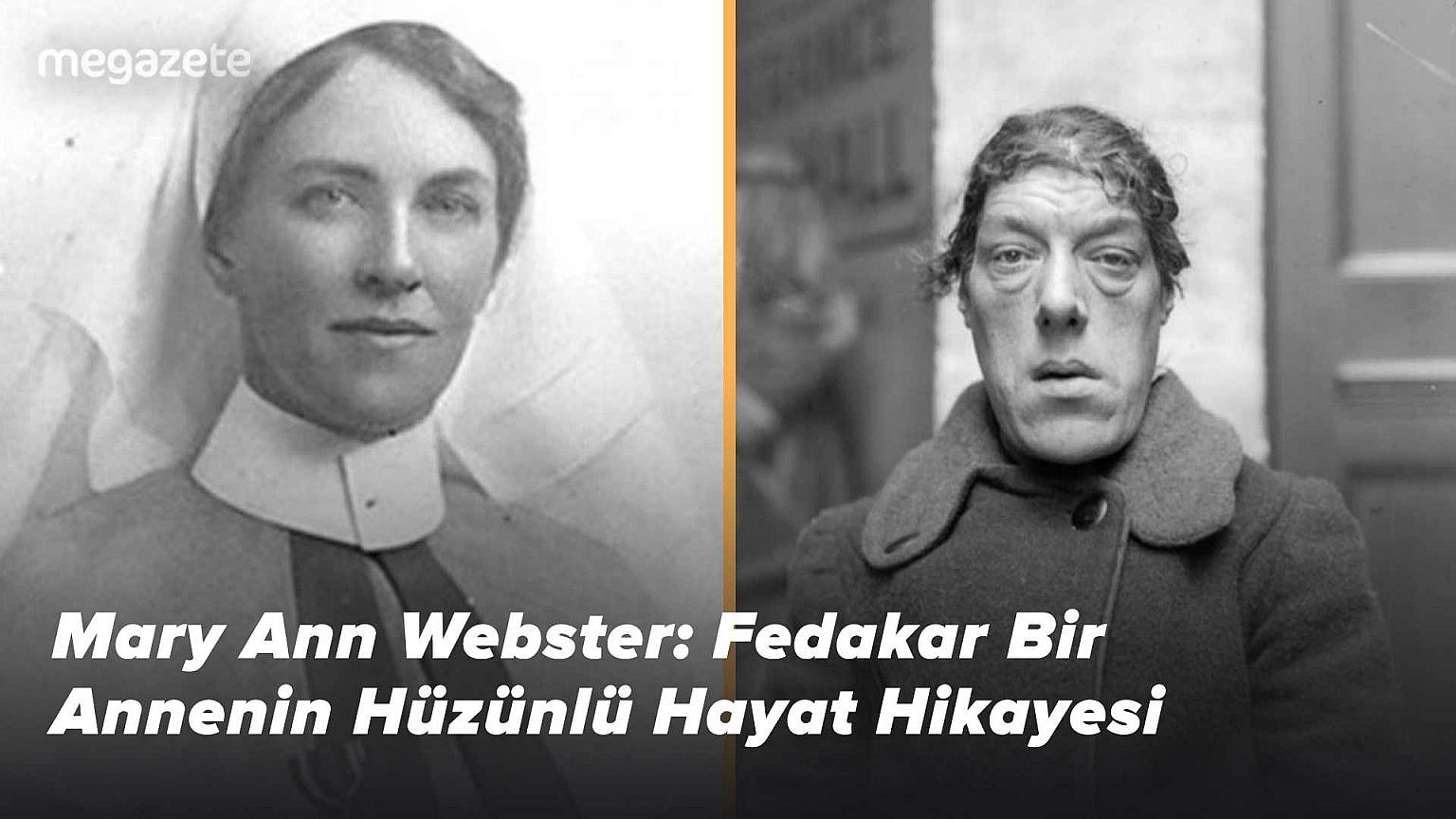 Mary Ann Webster: Fedakâr Bir Annenin Hüzünlü Hayat Hikâyesi - Megazete